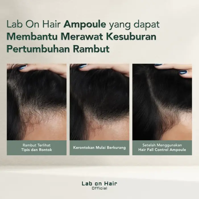 Lab On Hair Anti Hair Fall Ampoule - Ukhti Osaka